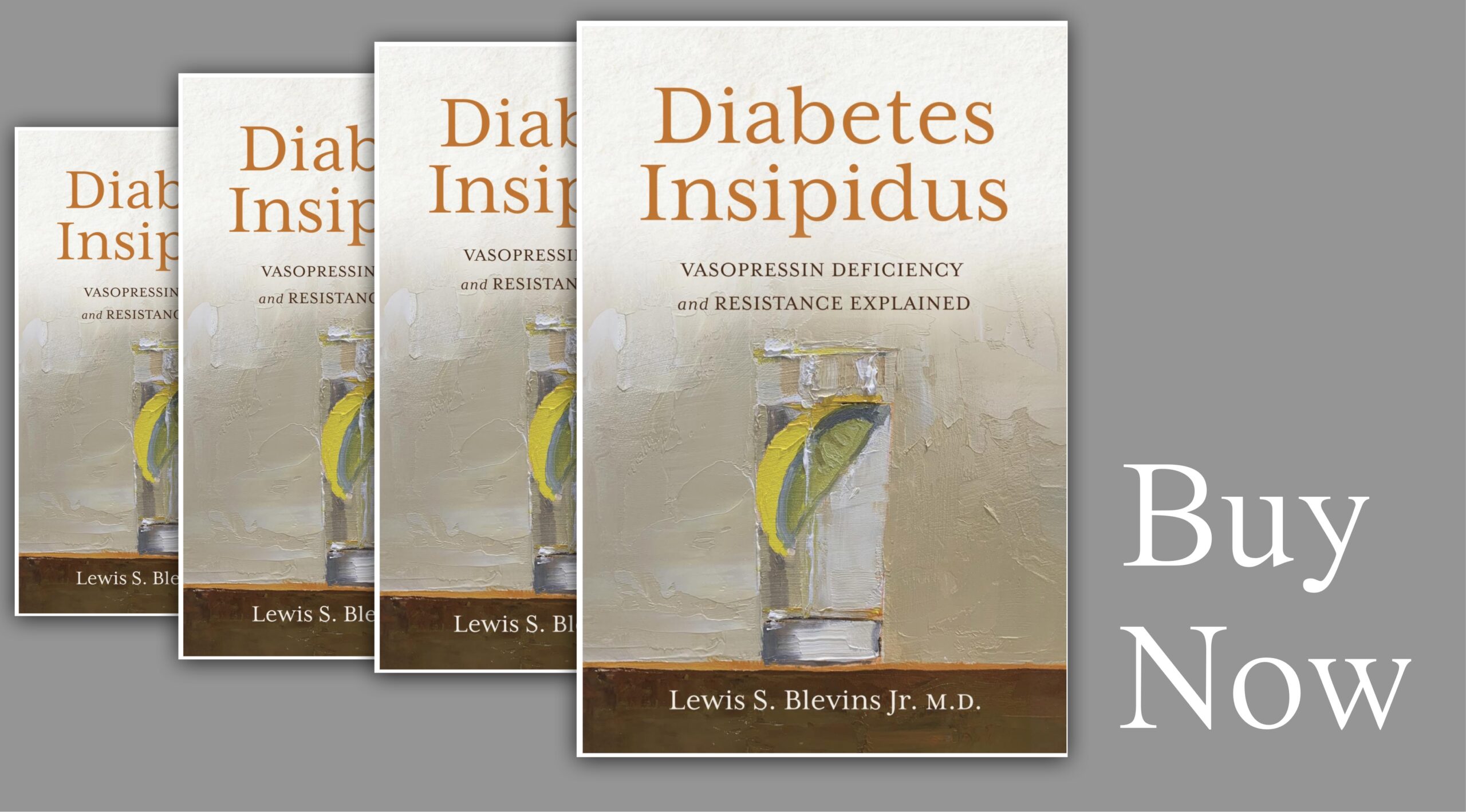 "Diabetes Insipidus: Vasopressin Deficiency and Resistance Explained ...
